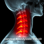 Understanding Cervical Spondylosis: ICD-10 Codes